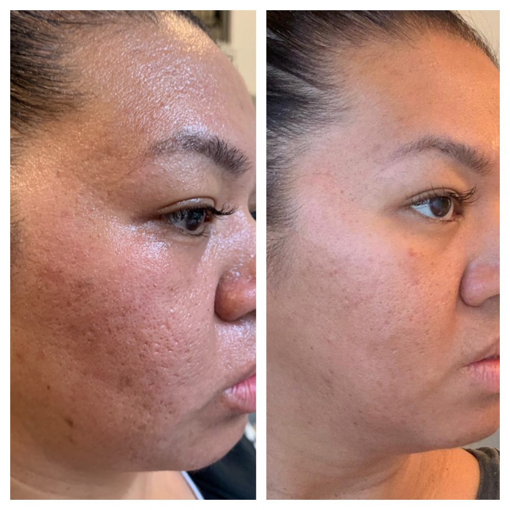Regenerative Aesthetics Training Course Medical Aesthetics Training